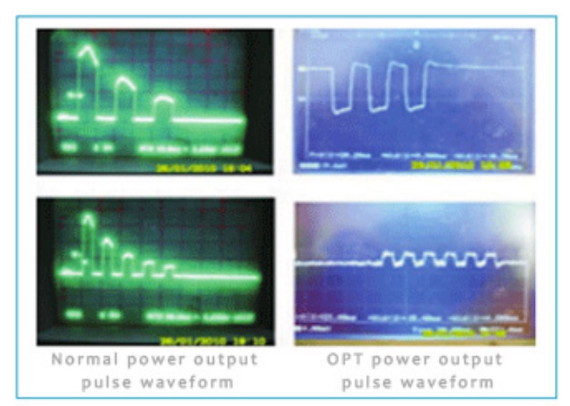HONKON Revolutionizes Skincare with Advanced OPT Beauty Technology